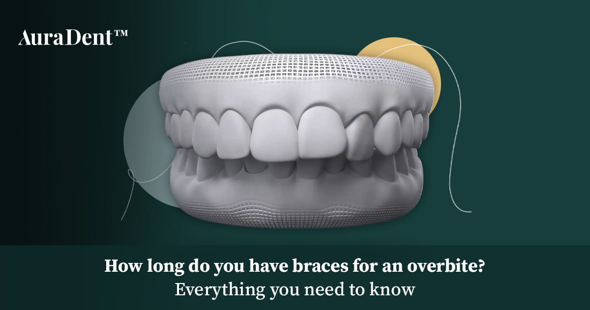How Long Do You Wear Braces for Overbite? | AuraDent™ Blog